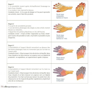 Les gelures : Médecine tactique CITERA 69 - Baron Desgenettes